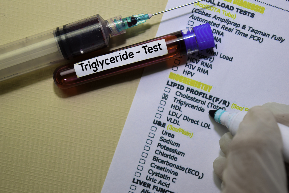 Understanding Triglycerides: Structure, Function, and Health ...